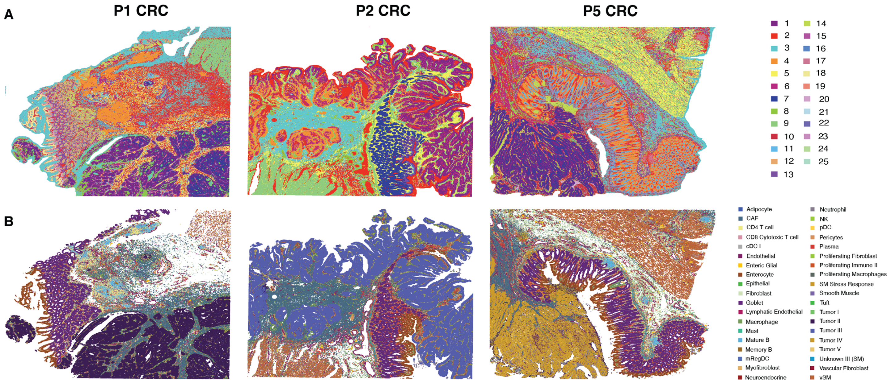 How mapping the spatial biology of the tumor microenvironment can benefit cancer drug discovery ...